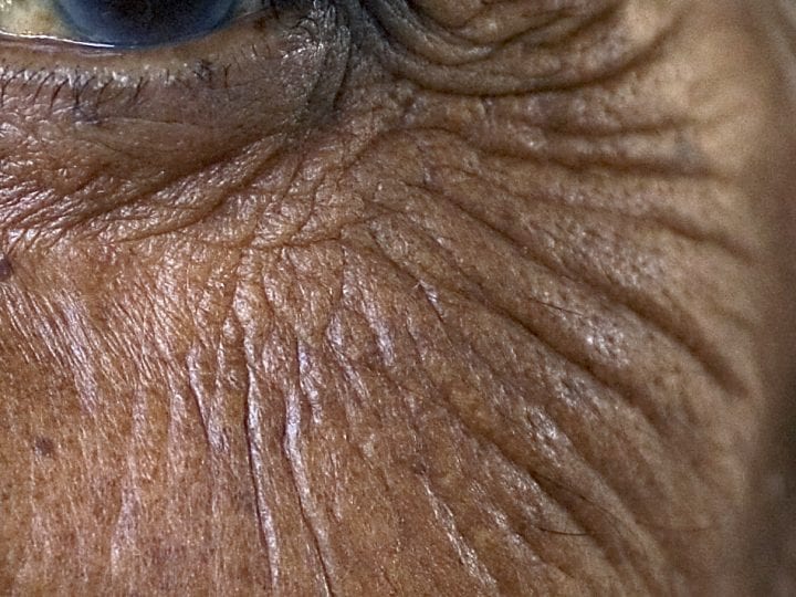 Skin Protects From Water Loss — Biological Strategy — AskNature