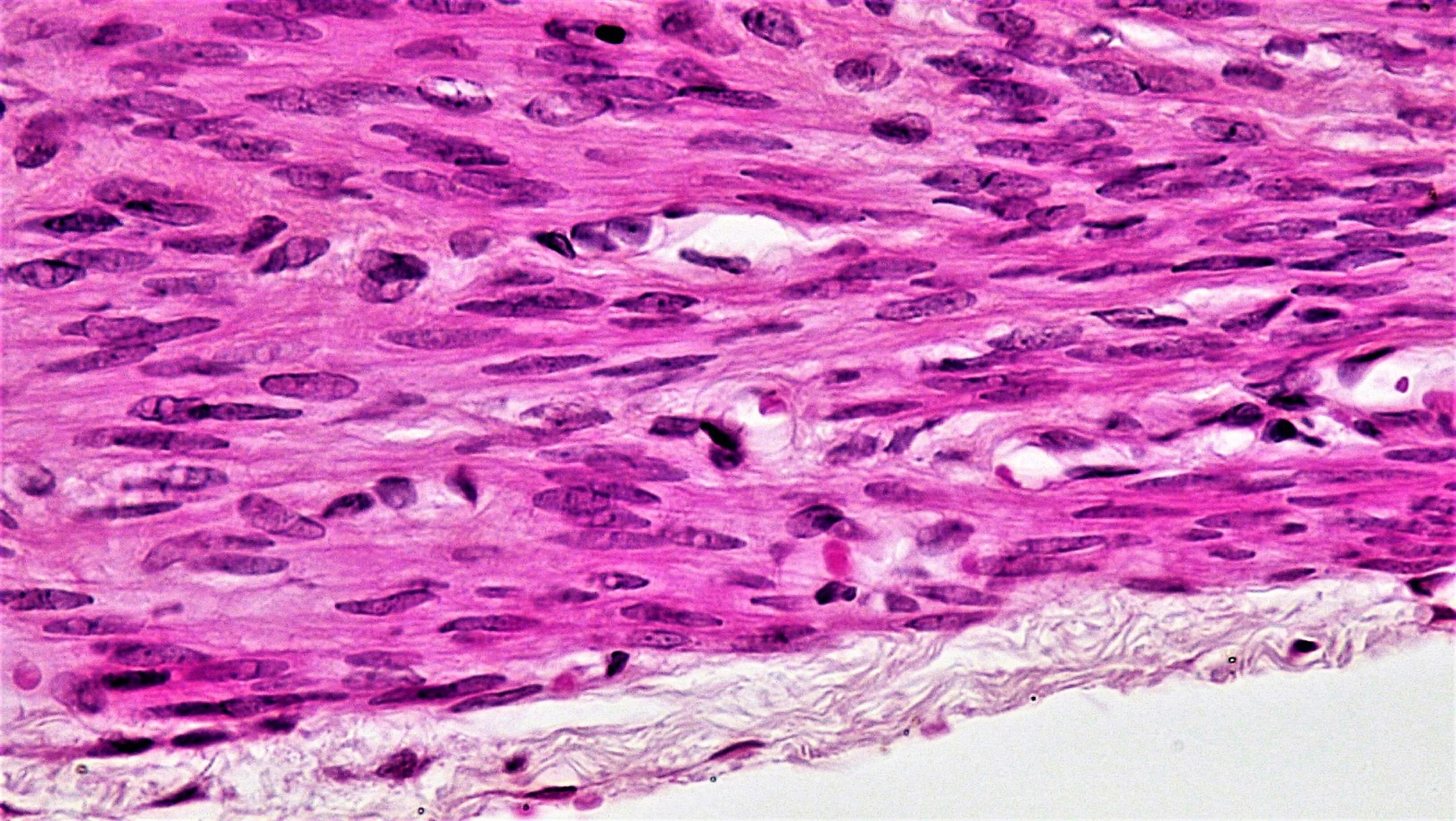 Muscles Self-repair — Biological Strategy — AskNature