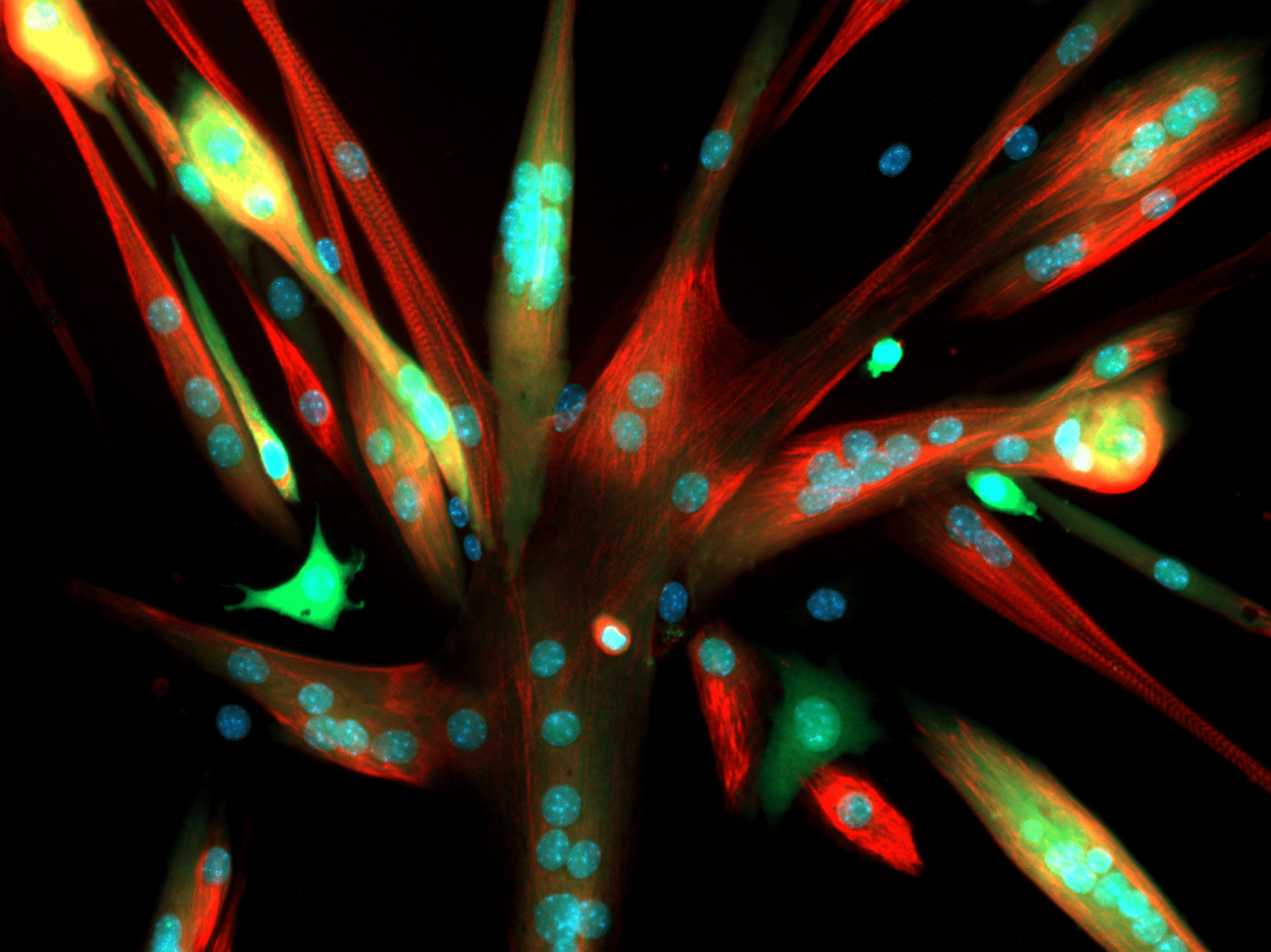 Les muscles squelettiques génèrent de la force - Stratégie biologique ...