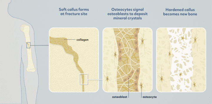 Bones Heal Themselves — Biological Strategy — AskNature