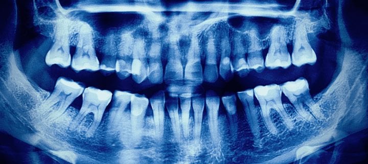 Spliced Collagen Anchors Teeth — Biological Strategy — AskNature
